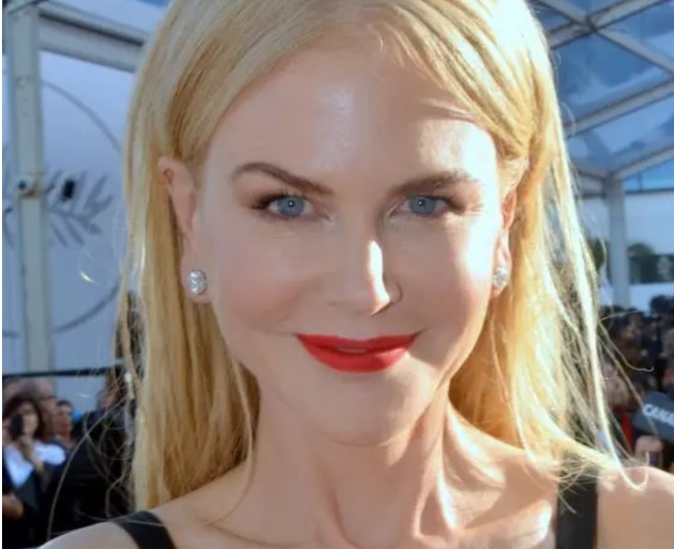 After yet another cosmetic procedure, Nicole Kidman was compared to a ...